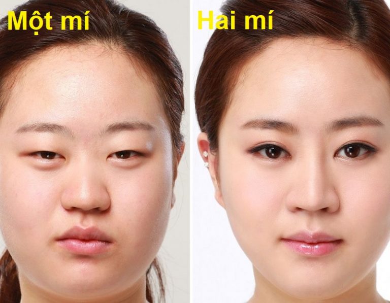 Xem tướng người mắt một mí tốt hay xấu, có phải là lươn lẹo?
